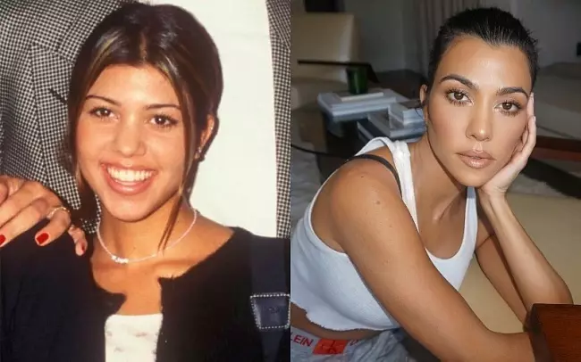 Pila ka milyon ang nagasto sa Kardashian sister sa plastic surgery? Litrato numero 10