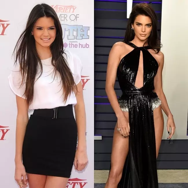 Pila ka milyon ang nagasto sa Kardashian sister sa plastic surgery? Litrato numero 12