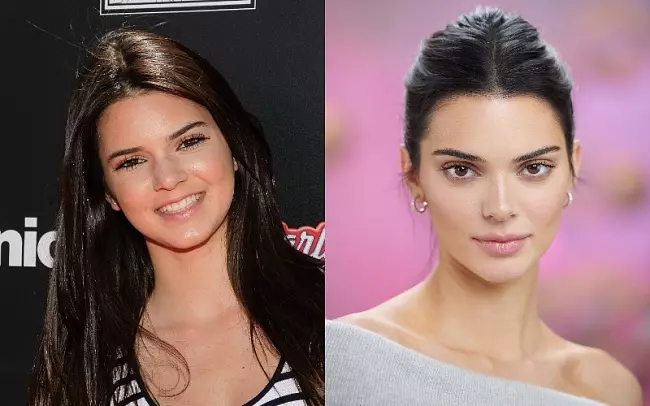 Pila ka milyon ang nagasto sa Kardashian sister sa plastic surgery? Litrato numero 13