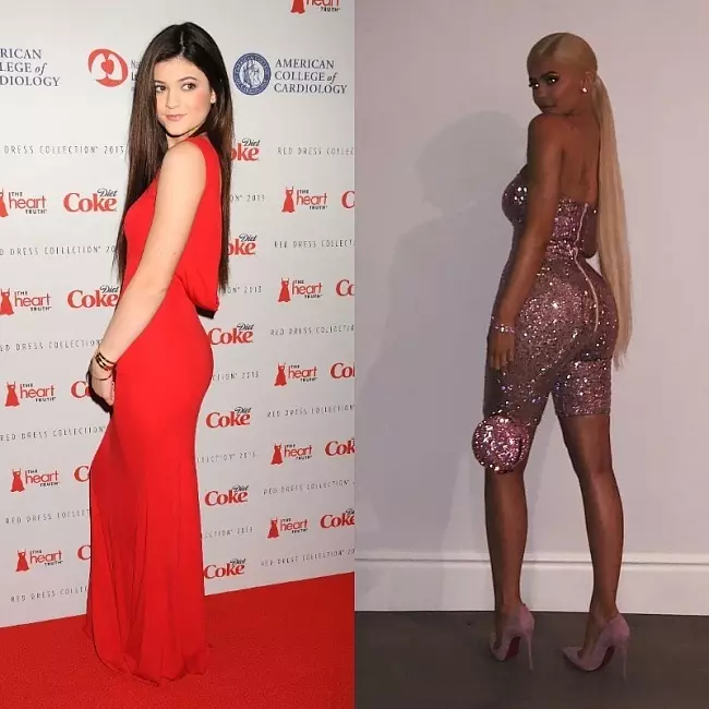 Sa milionë shpenzuan motrat Kardashian për operacione plastike?Foto numër 2