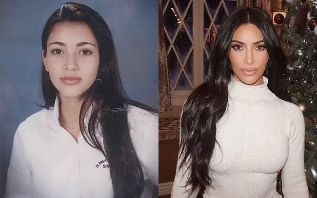 Kardashian opa-singillari plastik jarrohlik uchun qancha million sarfladilar? 4-rasm