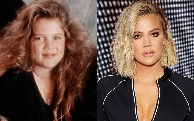 Pila ka milyon ang nagasto sa Kardashian sister sa plastic surgery? Photo number 6